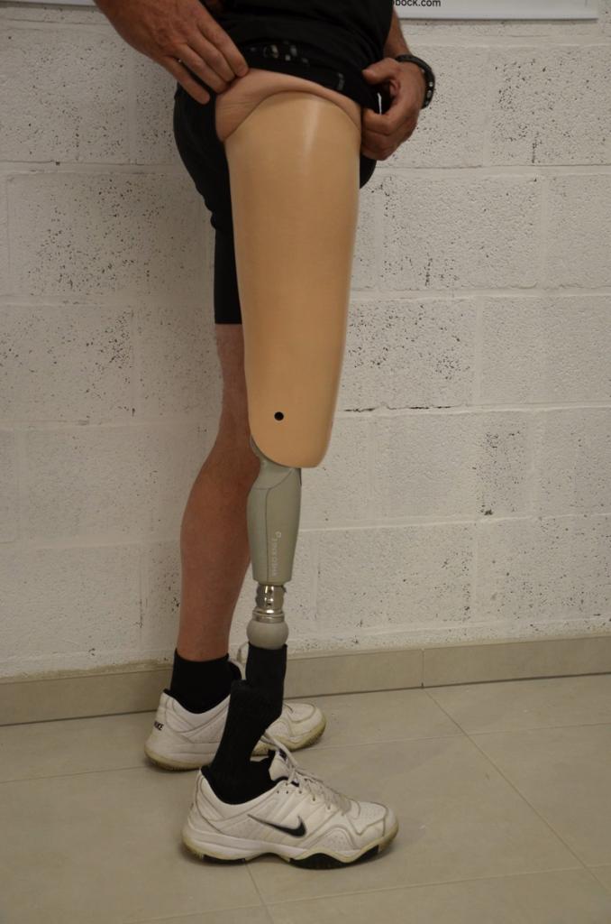 prothèse cuisse avec cache genou